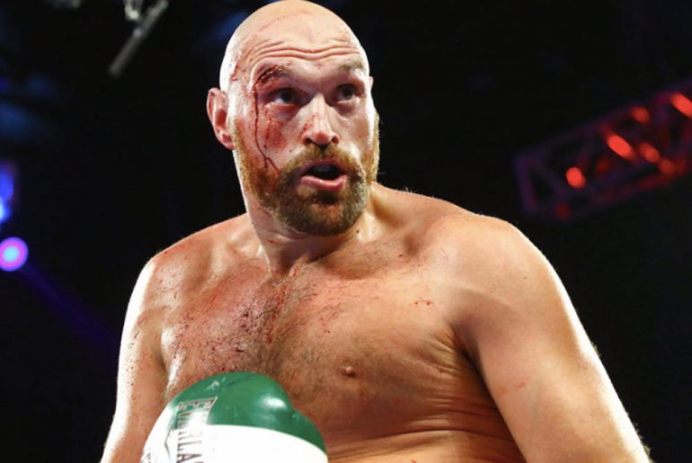 Tyson Fury Next Fight, Loss, Record, Brother, Height, Dad - ABTC