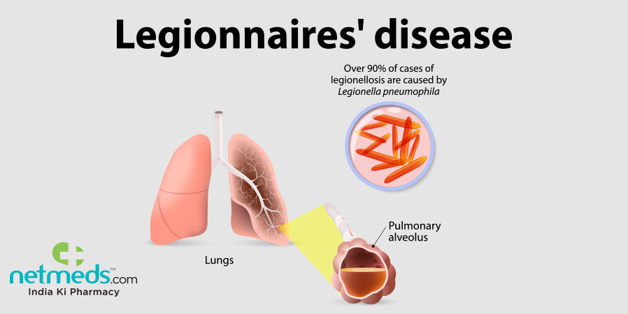Legionnaires' Disease : Symptoms, Causes, Treatment and Prevention. - ABTC