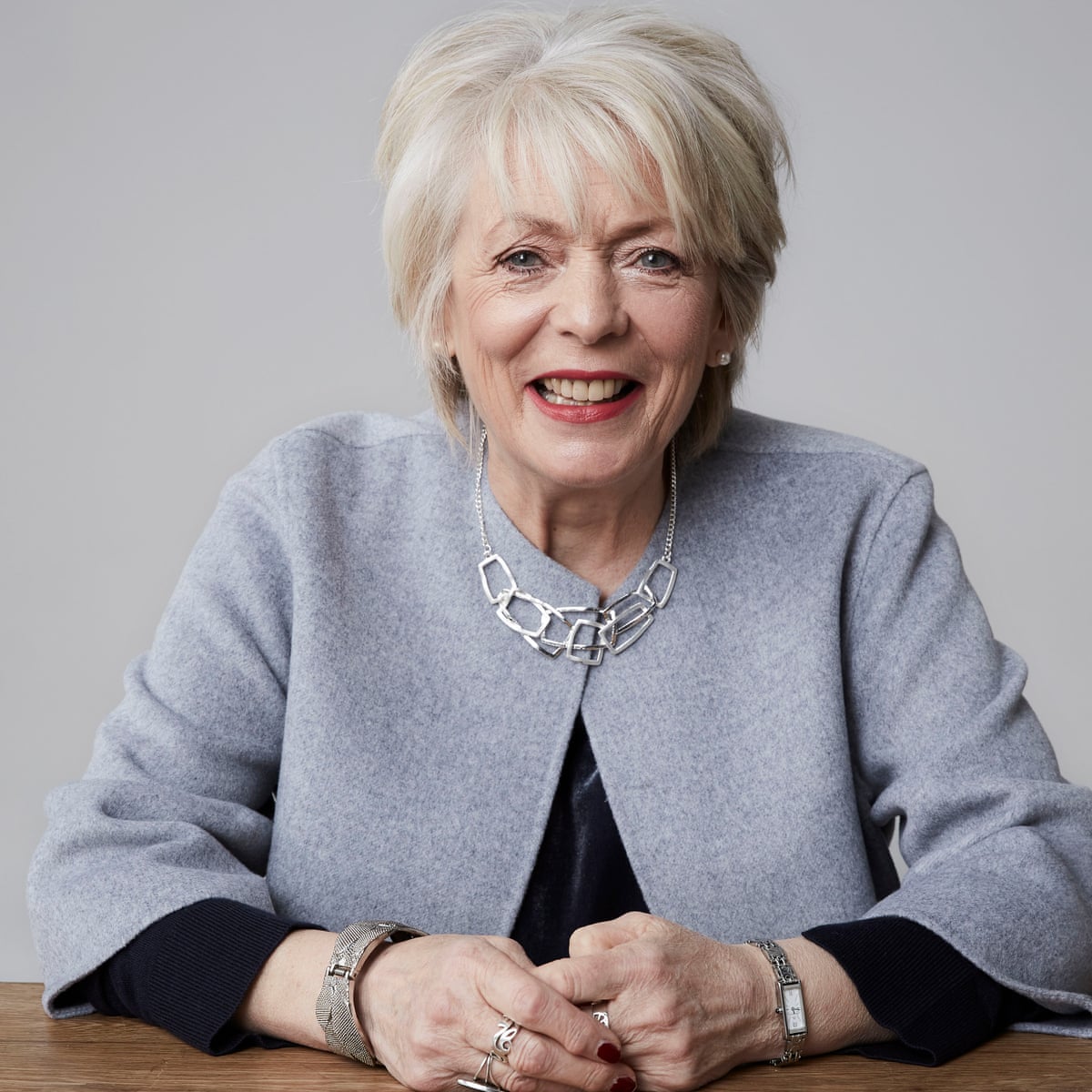 Does Alison Steadman have Dupuytren's contracture? - ABTC